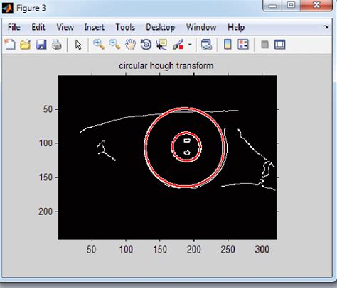 Eye Image After Applying Circular Hough Transform Download