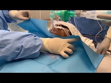 Tracheostomy Procedure Steps