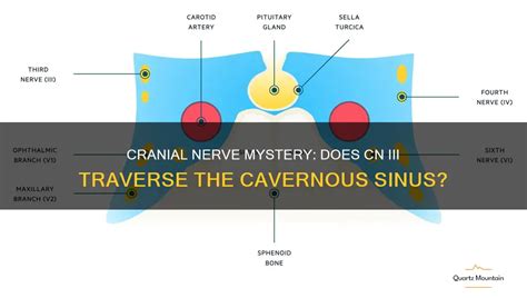 Cranial Nerve Mystery Does Cn Iii Traverse The Cavernous Sinus