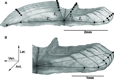 Cross Sections Of The Left Sagittal Otolith From A Six Year Old S Download Scientific Diagram