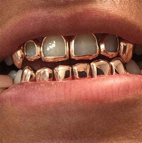 10k Gold Grillz Gold Teeth Master