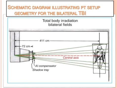 Total Body Irradiation Ppt For Radiology Pptx