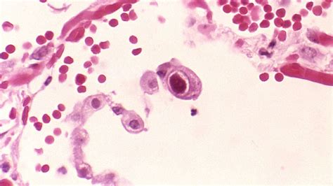 Le Stress Accélère Le Vieillissement Du Système Immunitaire Selon Une