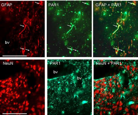 Ihc Identification Of Par1 Positive Cell Types In Nst Download Scientific Diagram
