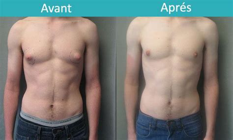 Seins Chez Les Hommes Clearance Website Jkuat Ac Ke