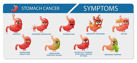 Infographie Sur Les Symptômes Du Cancer De Lestomac Joli Personnage