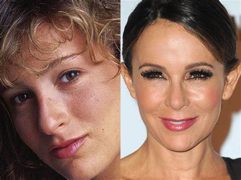 Celebrity Plastic Surgery Gone Wrong Before And After