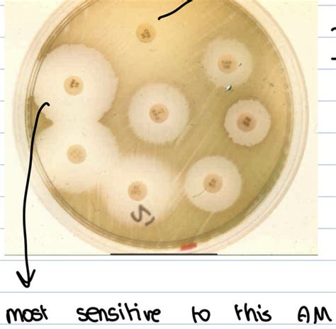 Antimicrobial Resistance Flashcards Quizlet