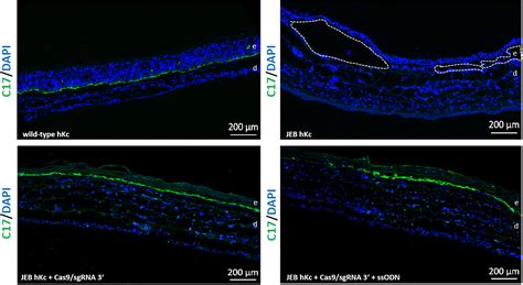 Crisprcas9 Mediated In Situ Correction Of Lamb3 Gene In