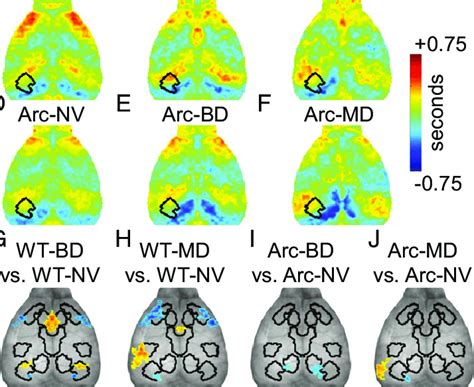 Bd And Md Result In Selective Short And Long Distance Propagation