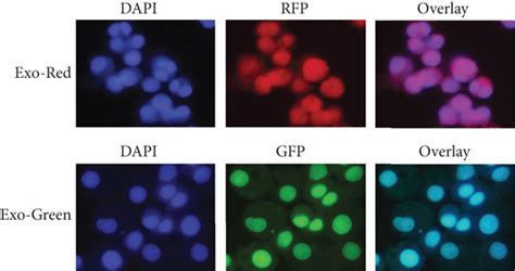 Characterization Of Bmsc Derived Exosomes A Nanoparticle Trafficking