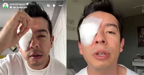 El influencer Ami Rodríguez tuvo fuerte accidente en su ojo Bogota