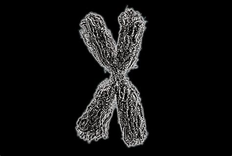 New Study Shows Why Theres A Sex Bias For Asd Adhd And Tourettes