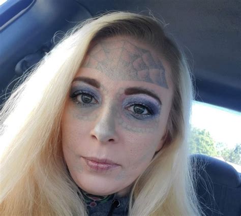 Woman Undergoing Years Of Laser Treatment To Undo Tattooed Face Uk News Metro News