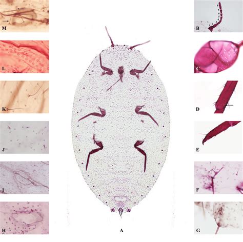 Diagnostic Characters Of A Slidemounted Adult Female Of Planococcus Download Scientific Diagram