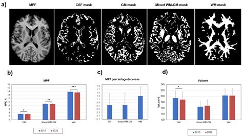 Biomedicines Free Full Text Age Related Decline In Brain Myelination Quantitative