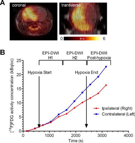 Simultaneous PET MRI Imaging During Mouse Cerebral Hypoxia Ischemia Scientific Article Protocol