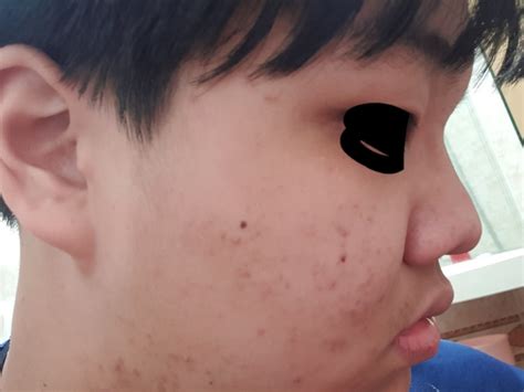 코가 작고낮은가요 지식in