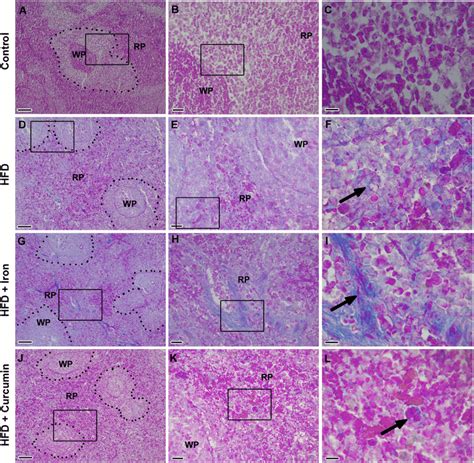 Photomicrographs Of Sections Of Spleen Stained With Massons Trichrome Download Scientific