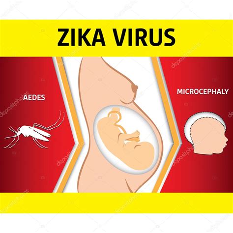 Ilustración de una embarazada con el virus del Zika y un bebé recién