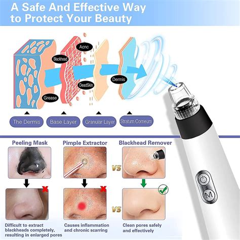 Blackhead Remover Pore Vacuum Cleanerupgraded Facial Blackhead Remover