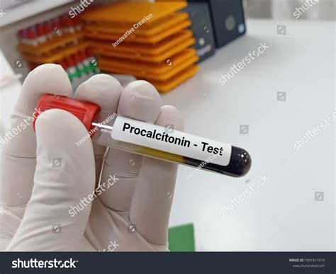 19 Pct Test Images Stock Photos Vectors Shutterstock