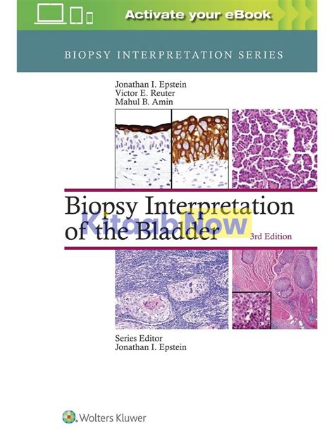 Biopsy Interpretation Of The Bladder 3rd Edition Kitaabnow