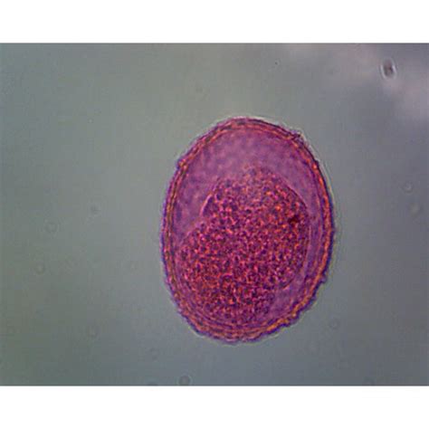 Prepared Microscope Slide Ascaris Lumbricoides Eggs W M