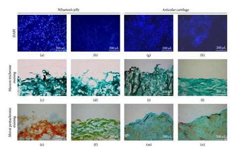 Histological Evaluation Of Decellularized Ecms B D F H L And N