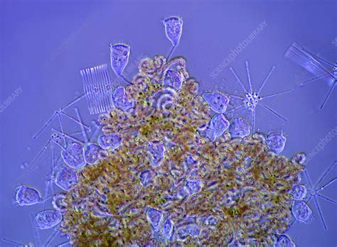 Diatoms Light Micrograph Stock Image C049 1428 Science Photo Library