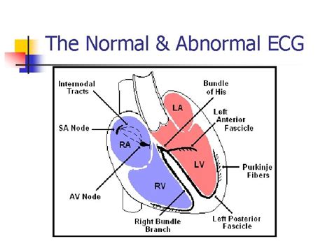 The Normal Abnormal Ecg Waveforms All Limb Leads