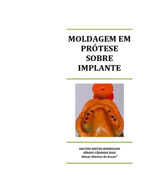 Moldagem Em Prótese Sobre Implante Pdf Prótese Tempo