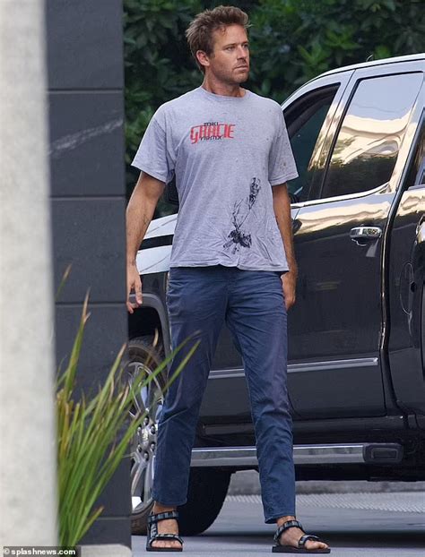 ‘식인·성폭행 논란 아미 해머 초췌한 근황