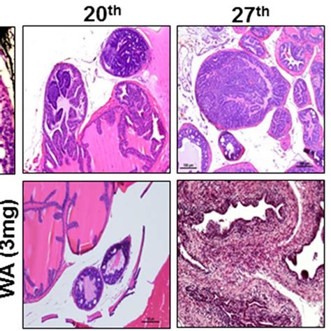 A Diagrammatic Representation Of Tramp Mouse Prostate Carcinogenesis