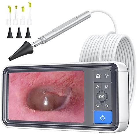 Scopearound Otoscope Ear Camera With 4 5 Ips Screen Fhd Digital Otoscope With Gyroscope Fsa