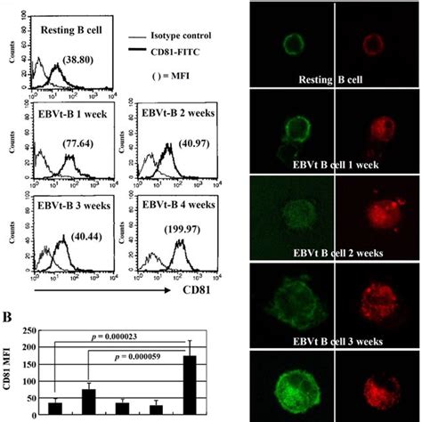 Apoptosis And Cell Cycle Arrest Of Epstein Barr Virus Ebv Transformed