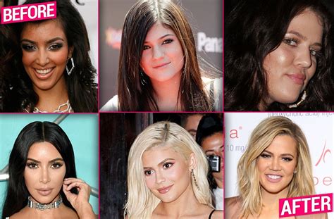 Kim Kardashian Plastic Surgery Before And After
