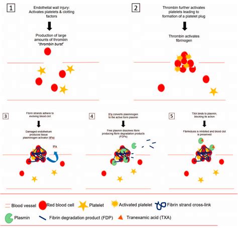 Tranexamic Acid Wfsa Resources
