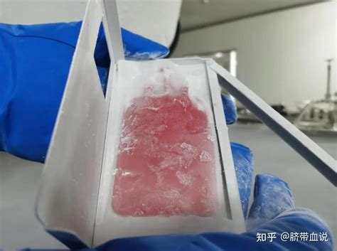 先科普后应用，你知道脐带血都有什么成分吗？ 知乎