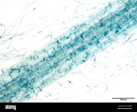 Hair Root Microscope