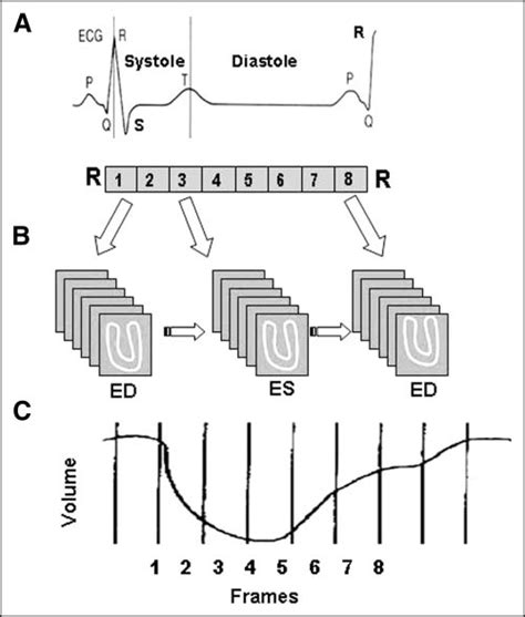 Principle Of Ecg Gated Acquisition R R Interval On Download Scientific Diagram