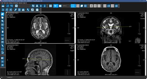 Dicom Viewer Reviews Pricing And Demos Softwareadvice Gb