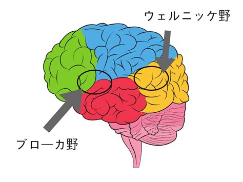 Images of くも膜顆粒 JapaneseClass jp