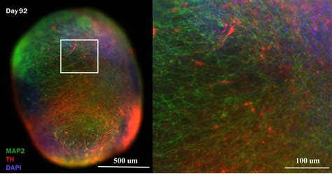 Human Ipsc Derived Cerebral Organoid Maturation And Maintenance Kit