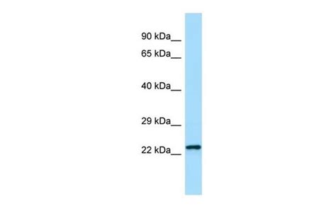 Chmp2b Polyclonal Antibody Pa5 70058