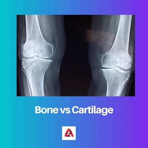Bone Vs Cartilage Difference And Comparison