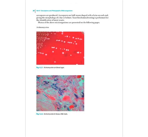 Atlas Of Clinically Important Fungi Bioweb® Colombia