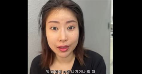 이세영 얼굴 전체 성형했습니다 아이유점 찍고 달라진 이목구비