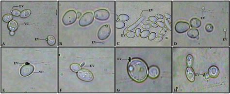 Release Of Extracellular Vesicle Ev From Candida Tropicalis Light