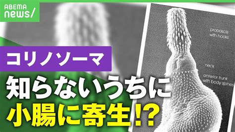【寄生虫】アニサキスの次は｢コリノソーマ｣？一部の魚の生食で小腸に寄生発見が困難で知らずに飼い主になる可能性も Moe Zine